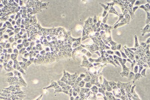 IncuCyte (Normoxia) – WK Lab